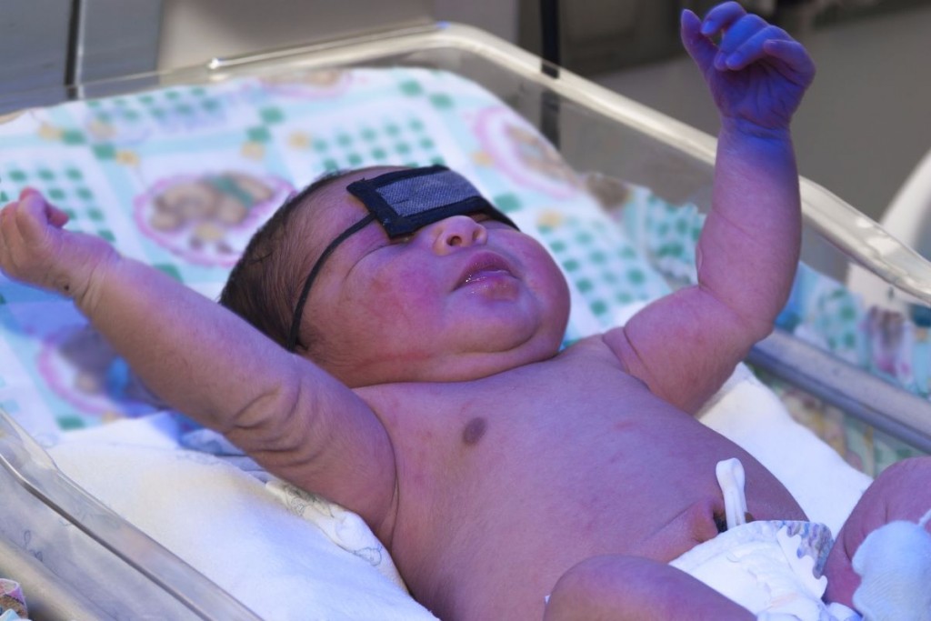 Síndrome de alcoholismo fetal - Facemama.com