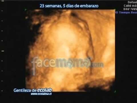 23 Semanas, 5 días de embarazo - Facemama.com